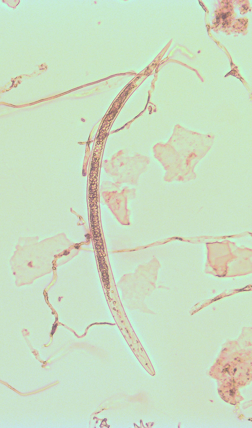 Let Us Handle The Nematodes So You Can Handle Everything Else ...