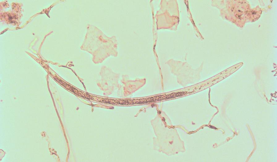 Expert Advice on How Fruit Growers Can Control Nematodes - Growing Produce